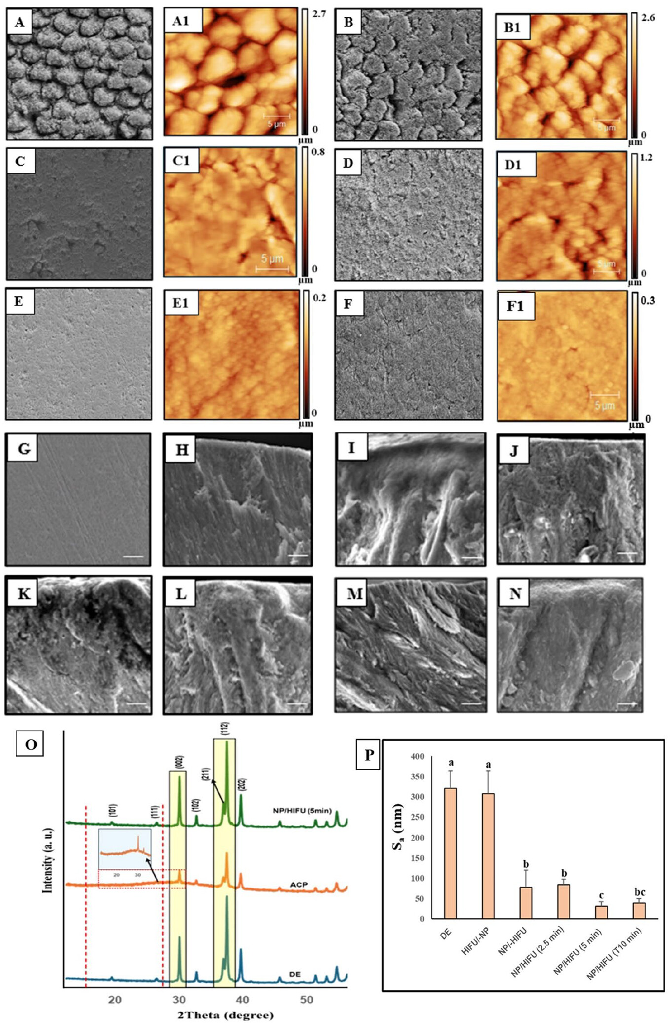 The latest method of enamel remineralization using high-intensity ...